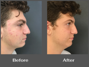 Gallery - Nathan Newman, M.D.