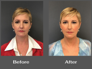 Gallery - Nathan Newman, M.D.