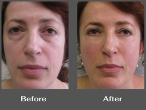 Gallery - Nathan Newman, M.D.