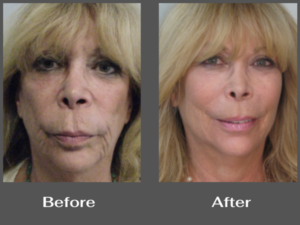 Gallery - Nathan Newman, M.D.