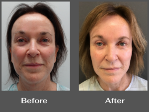 Gallery - Nathan Newman, M.D.