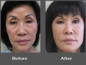 Gallery - Nathan Newman, M.D.