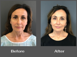 Gallery - Nathan Newman, M.D.