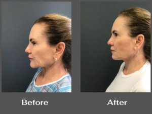 Gallery - Nathan Newman, M.D.