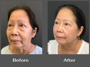 Gallery - Nathan Newman, M.D.