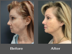 Gallery - Nathan Newman, M.D.