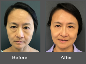 Gallery - Nathan Newman, M.D.