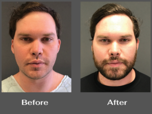 Gallery - Nathan Newman, M.D.